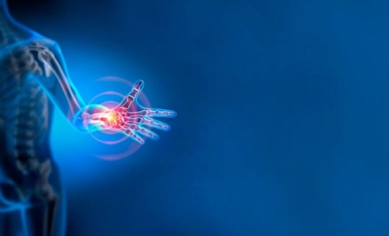 The ongoing challenge of RA treatment - Irish Pharmacist